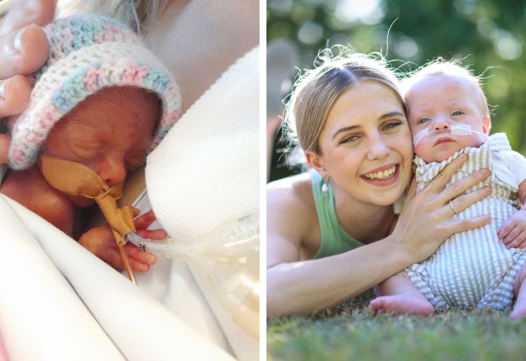 Brave Oliver Beats The Odds: 'He's A Fighter' - Mouths of Mums